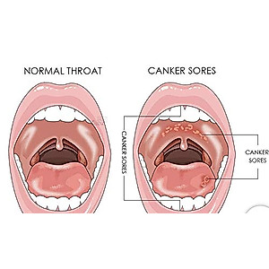 Miracle Brite Smile - 3% Hydrogen Peroxide MedicalFood Grade, Peppermint, Lemon, Clove Leaf, Cinnamon and Rosemary. Organic Essential Oils Leaving a Fresh Breath Mouth. 3 Bottles - 12 oz Bottles.