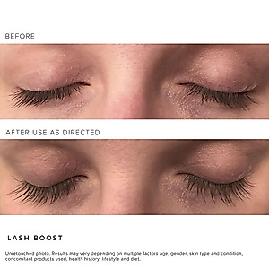 Rodan + Fields R+F Lash Boost Serum | 5 ml | Supports Fuller, Longer-Looking Eyelashes & Brows | Easy Nightly Application