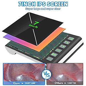 Digital Otoscope with 7.0 Inch Screen, Hiacinto 3.9mm Ear Camera with 6 LED Lights, 32GB Card, 10Pcs Disposable Specula, 12 Ear Spoons, Storage Case