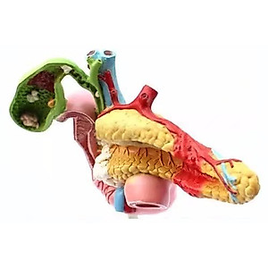 BoNew Human Duodenum Gall Bladder Disease Anatomy Medical Model Life Size