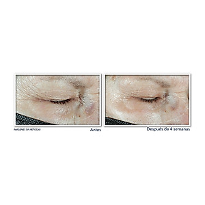 RoC Multi Correxion®, Hydrate + Plump, Eye Cream, 0.5 fl oz (15 ml)