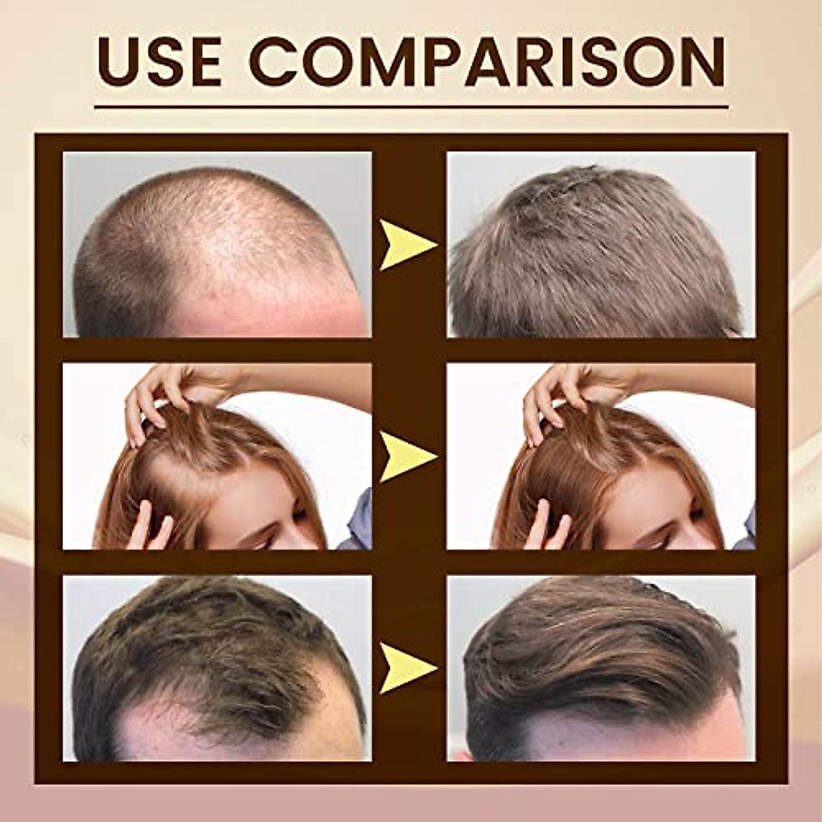 Ginger King Hair Nutrient Solution Nourishes hair roots, Polygonum Multiflorum And Ginger Herbal Hair Care Essence Nourishing Hair Hair Care Solution Preventing Hair Loss And Hair Density 30ml (1PCS)