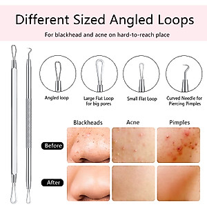 Xesscare Pimple Popper Tool Kit 7 Pcs Blackhead Remover Tool Comedones Tweezers Acne Extractor Blemish Whitehead Removal Tool for Facial, Nose and Forehead (Silver)