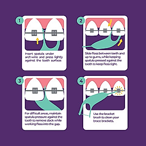 Platypus Orthodontic Flossers for Braces Family Pak - Unique Structure Fits Under Arch Wire, Increase Flossing Compliance, Floss Teeth in Less Than Two Minutes - 75 3-Count Flossers (225 Total)