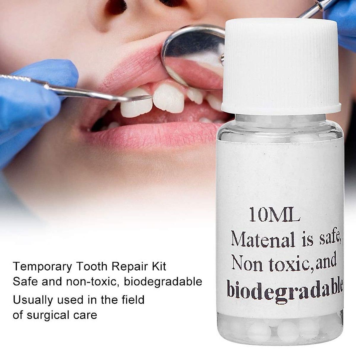 Temporary Tooth Repair Kit, Teeth Filling Dental Cavity Gaps Filling Material, Irregular Tooth Restoration Materials (10ML)
