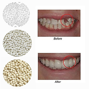 10pcs Dental Oral Fake Teeth Tooth Covers molds with 3Colors Repair Snap on Smile Veneers Dentures Adhesive Beads Cosmetic Kits