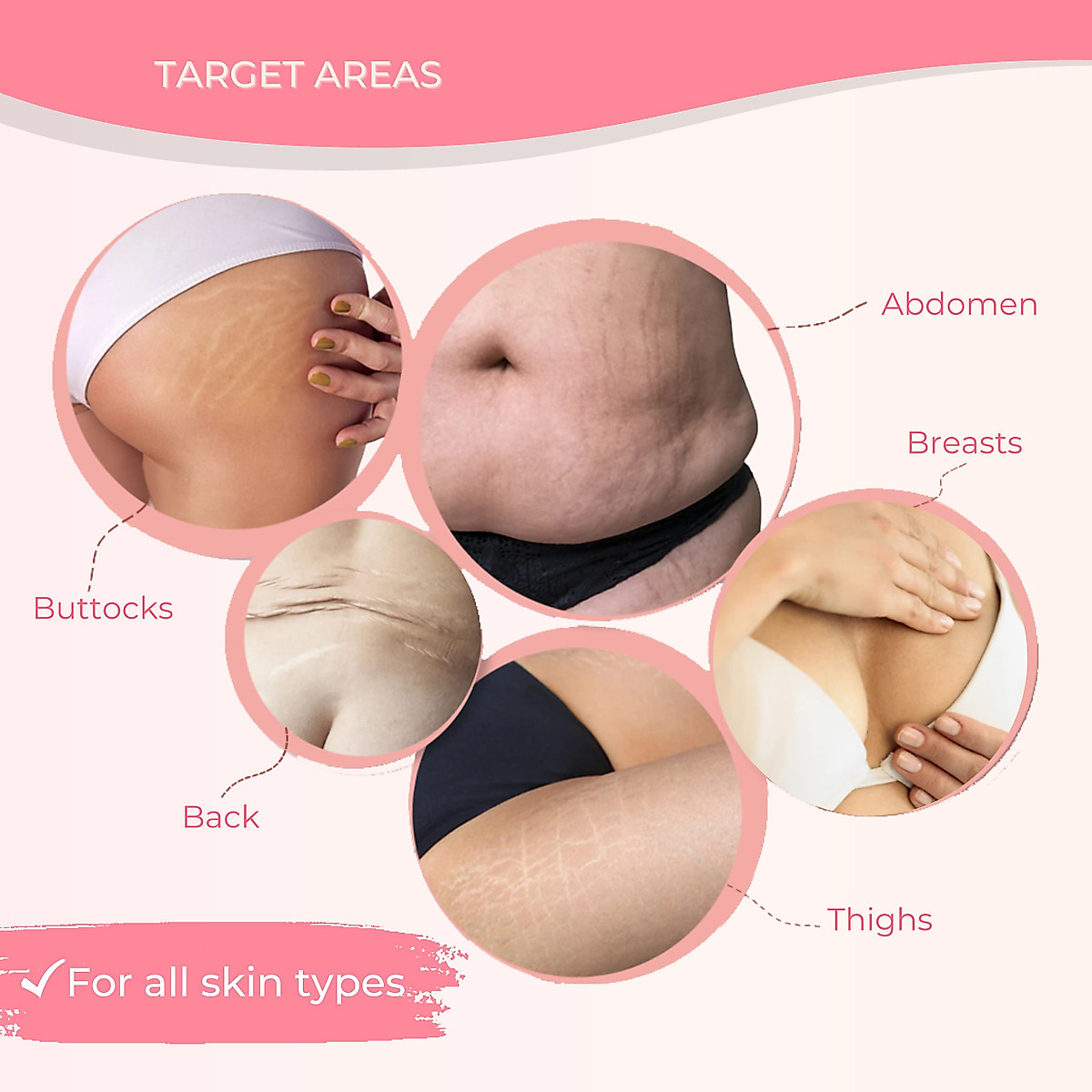 Levitural Stretch Mark & Scar Removal Cream for Pregnancy, Postpartum (2-in-1) - Maternity Skin Care Moisturizer Stretch Mark Prevention with Antioxidant Goji Extract - EXTRA LARGE Volume (8.8 Oz)