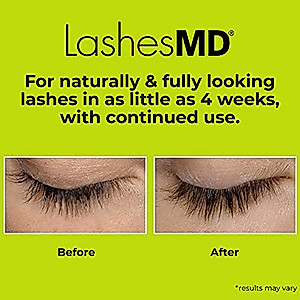 LashesMD Eyelash Growth Serum & Conditioner, 0.135 oz. – Naturally Enhances for Stronger, Thicker Lashes & Brows – Paraben & Cruelty Free – Clinically Formulated with Peptides & Botanicals