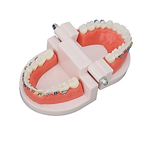 Teeth Model, Dental Teeth Kids Dental Teaching Study Supplies with Metal Bracket Dental Treatment Teeth Model for Dentist Research Dental Laboratory Fake Teeth Braces