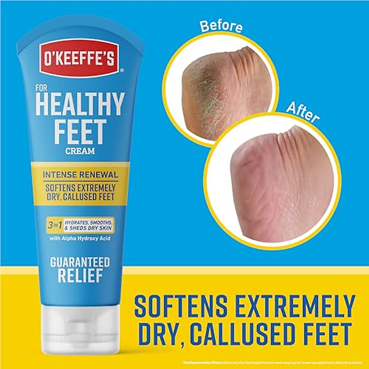 O'Keeffe's Healthy Feet Intense Renewal Cream with Alpha Hydroxy Acid; Softens and Exfoliates Extremely Dry; Callused Feet; 3oz Tube (Pack of 1)