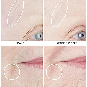 City Beauty UpLift Firming Serum - Face Serum - Lift & Tighten - Natural Sagging Skin Solution with Deep-Sea Extracts - Visibly Smooth Fine Lines & Wrinkles - - Cruelty-Free Skin Care