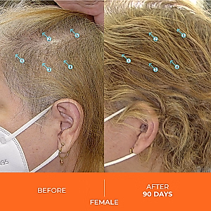 DS Laboratories Revita Tablets, Hair Supplement for Hair Growth Support, Zinc, Iron, Magnesium, Melatonin, Vitamin D & Biotin Vitamins for Women & Men, Hair Vitamins for Thicker Hair Growth, Hair Care