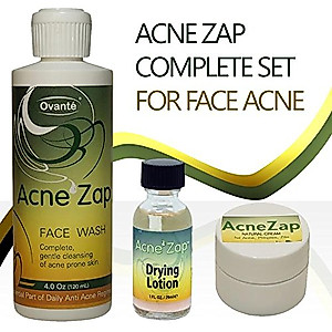 Acne Zap - Shampoo for Scalp Acne – Clear Scalp from Acne, Zits and Pimples 6.0 oz