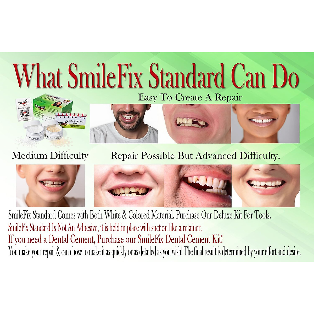 SmileFix Standard Dental Repair Kit - Color Matching Compound - For Missing Or Damaged Teeth - Fix Gaps, Broken Tooth, Spaces - Durable Repair - Fast & Easy - Confident Smiles