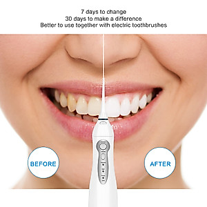 TOVENDOR Electric Water Flosser, Cordless Rechargeable Dental Oral Irrigator IPX7 Waterproof 300ML Travel Water Teeth Cleaner with 5 Tips for Braces Care Teeth Gums Cleaning, Home Office Daily Use