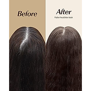 FOAMIST Hair Scalp & Thickening with Basil Mint and Caffeine no Chemical Hair Shampoo & Hair Conditioner SET for hair loss, Scalp 250ml / 8.4 fl.oz (2 Packs)