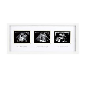 Pearhead Trimester Progression Sonogram Picture Frame, Pregnancy Milestone Keepsake Photo Frame, Sonogram Keepsake, Gender-Neutral Baby Nursery Décor