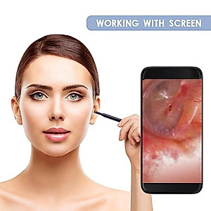 Ear Wax Removal Personal Care USB Ear Camera,Nose Camera, Throat Camera, Skin Camera for Kids, Adults, Pet,Compatible with Androids & Windows & Macs,NOT for iPhone/iPad