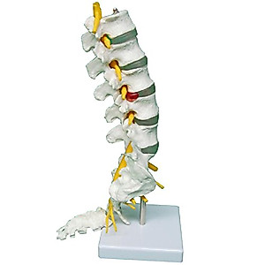 tinsay Anatomical Human Spine Model Consists of 5 Lumbar Vertebrae with Intervertebral Discs,Lumbar Nerves and Spinal Cord.