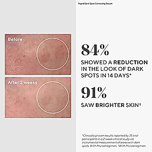 Murad Brighten Trial Kit – Brightening Skin Care Kit - Daily Protection Creams Set with Trial Size Essential-C Cleanser, Essential-C Day Moisture, Vitamin C Serum & Rapid Dark Spot Correcting Cream ($94 Value)