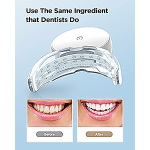 Teeth Whitening Strips with Light, 28 Dentist-Level White Strips for Teeth Whitening, Rechargeable 24X Blue Teeth Whitening Light, Teeth Whitening Kit with Led Light