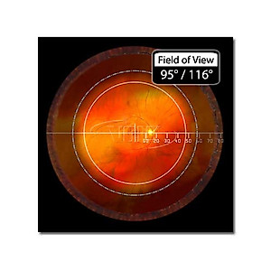 Volk SuperField NC Slit Lamp Lens - Red