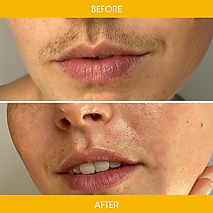 Nad's Facial Wax Strips - Natural All Skin Types - Waxing Kit With 30 Face Wax Strips & Post Wax Oil, 1 Count