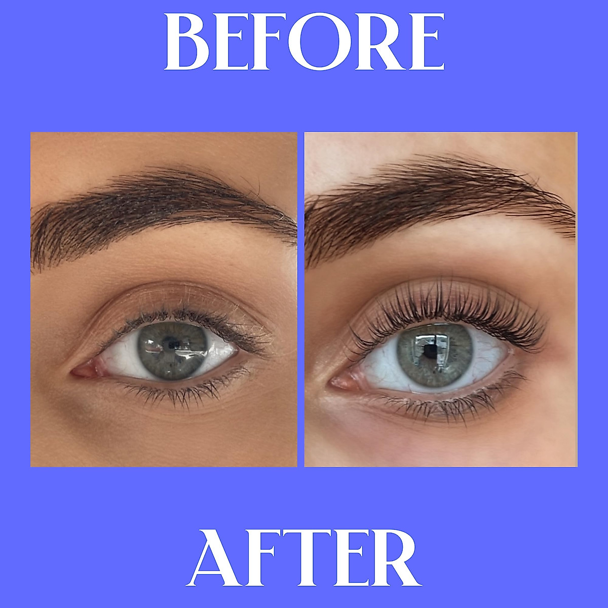 Xlash Eyelash Enhancer Serum (3 mL / 0.10 fl oz)