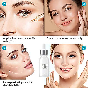 Rejopes Dark Spot Corrector Remover for Face and Body, Dark Spot Remover with Natural Ingredients,1.7 Fl Oz