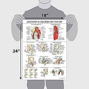 Palace Learning Laminated Anatomy and Injuries of the Hip Poster - Hip Joint Anatomical Chart - 18" x 24"