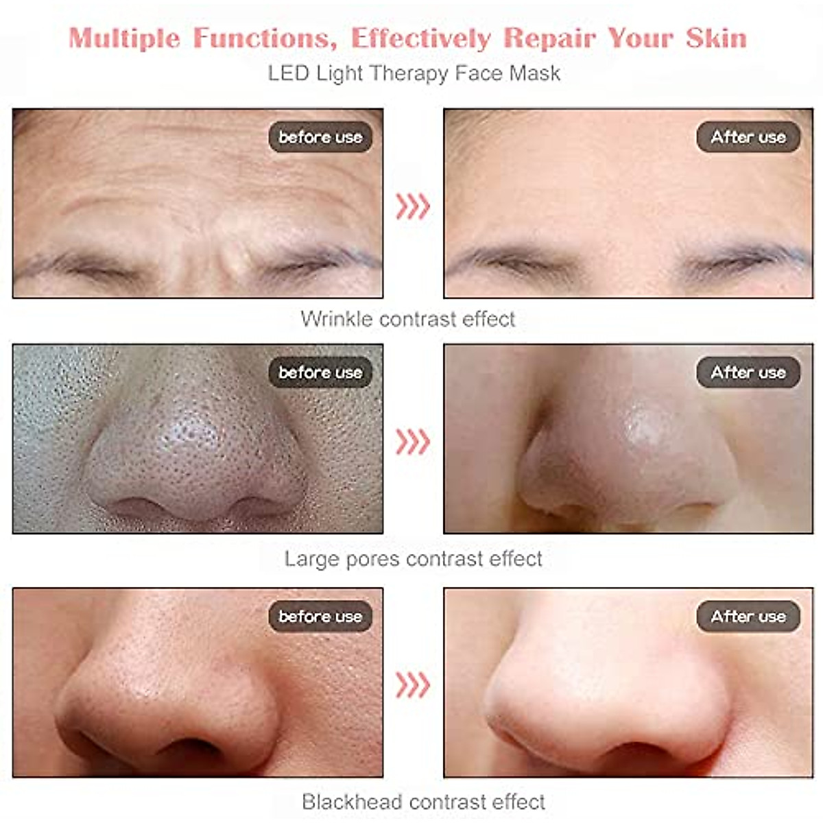 7 Colors Light Portable Face & Neck M -Ask Machine for Home Use | 7 Colors