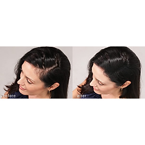 LUXE Hair Thickening Fibers - CONFIDENCE IN A JAR – 2 Months+ Supply! – Hypoallergenic, Dermatologist Tested – Multiple Colors Available (Dark Brown)