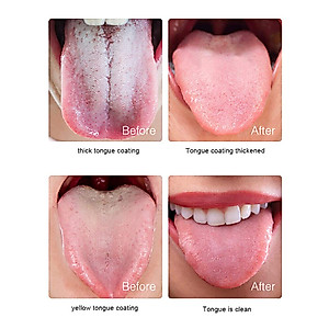 lunhaifi 2023 New Probiotic Tongue Cleaning Gel Set, Tongue Scraper Precise Cleaning Brush Kit, Easy to Use Tongue Scrubber for Men Women with 1Tongue Brush (Mint+Peaches)