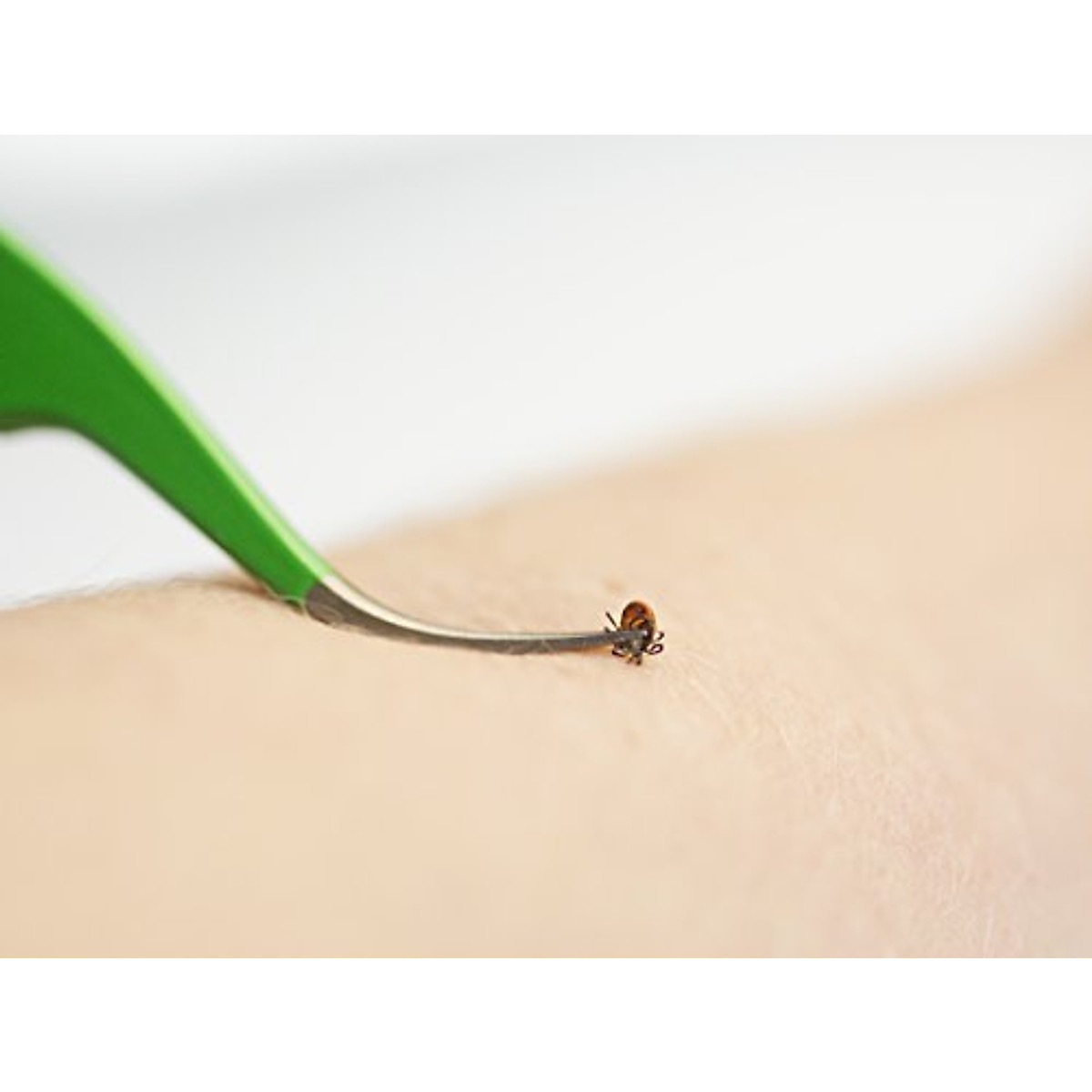 TickCheck Premium Tick Remover Kit - Stainless Steel Tick Remover + Tweezers, Leather Case, and Free Pocket Tick Identification Card (1 Set)