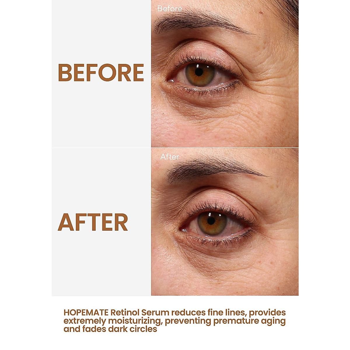 HOPEMATE Natural Facial Retinol Serum with Hyaluronic Acid& Vitamin E, New Skin Treatment Formula, Organic Anti Wrinkle Reducer, Anti Aging Moisturizer, Dark Circles, Scar, Sun Damage Corrector