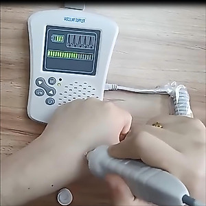 8Mhz Probe Handheld Doppler Blood Flow Rate Speed Monitor、Blood Flow Strength Detector、Detect arterial/venous Blood Flow Status and Average Blood Flow Velocity