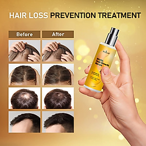 Biotin Hair Growth Serum with Castor Oil, Argan Oil - Hair Loss Prevention Treatment with Hair Regrowth Formula for Women by Beaueli
