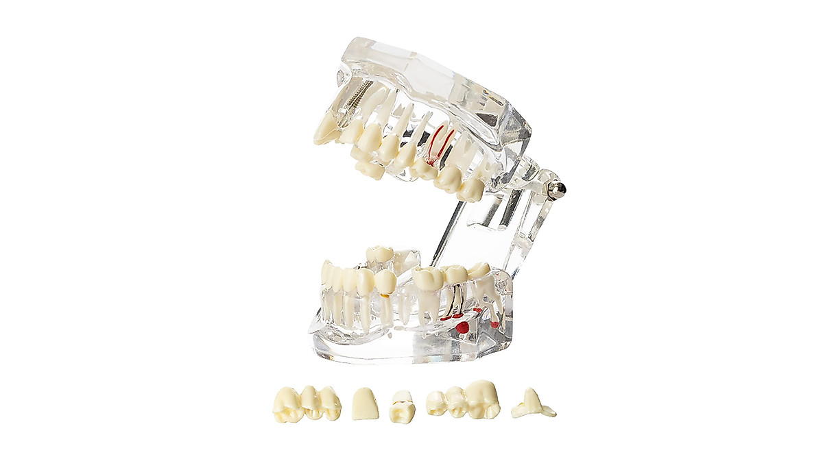 Dentalmall Implant Typodont Model for Education