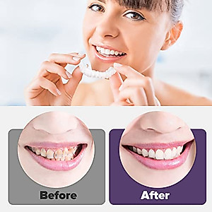 2 PCS Dentures Teeth for Women and Men, Dental Veneers for Temporary Teeth Restoration, Nature and Comfortable, Protect Your Teeth and Regain Confident Smile, Natural Shade-11