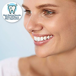 Ultra White 16% Teeth Whitening Gel Large 5 Tubes of Gel