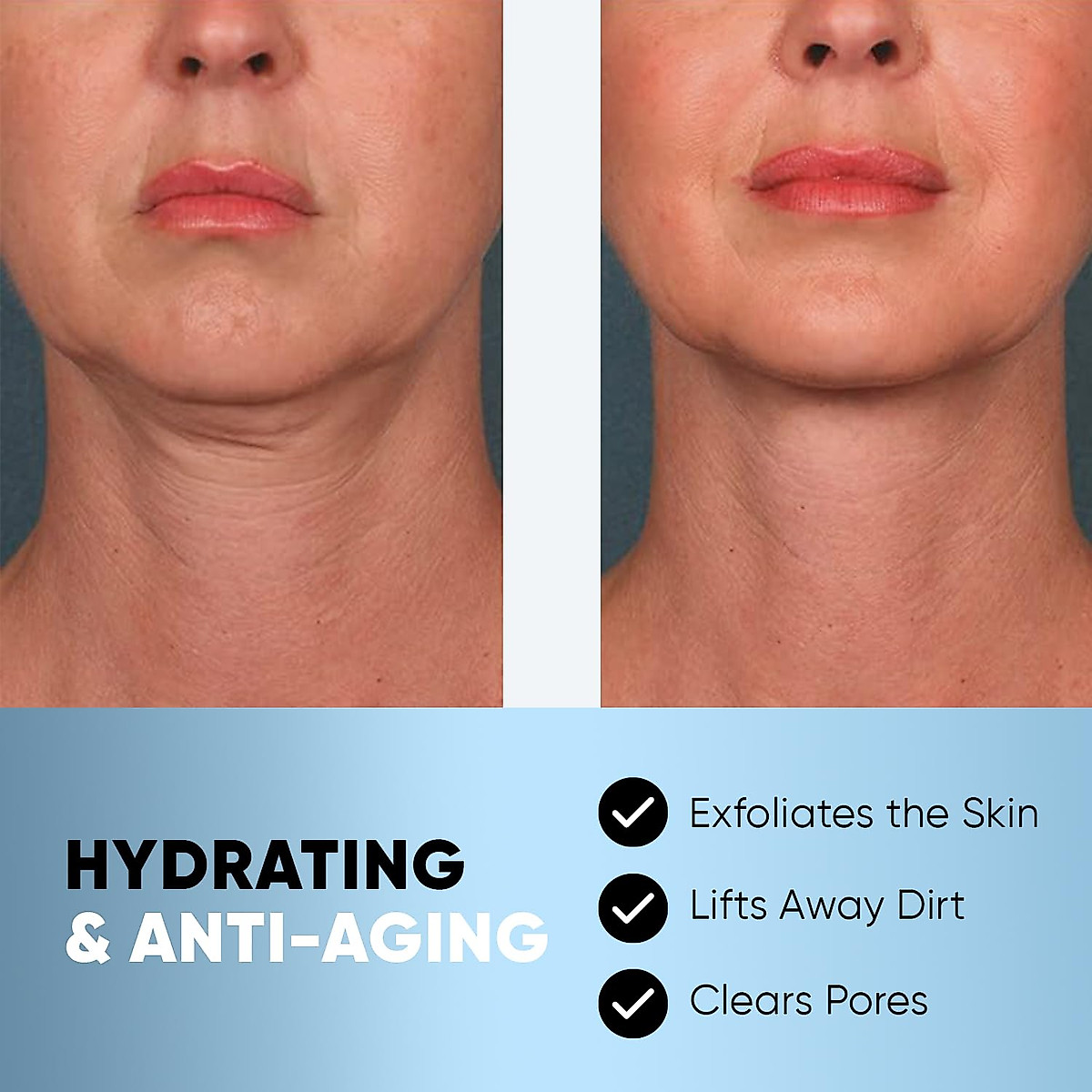 ESTETIST V Shaped Slimming Face Mask, Face Lift Tape Tightening Mask Anti Aging Anti Wrinkle Firming Jawline Slimmer V Line Lifting Belt Face Patch For Firming and Tightening Skin (5 Pack)