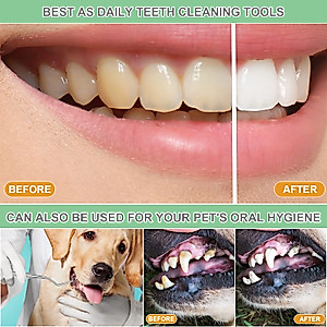 Dental Tools, Professional Dental Pick Tools Kit, Teeth Cleaning Calculus Tool for Dentist, Personal Using, Pets Oral Care with Dental Mirror Dental Tooth Tartar Plaque Scraper Remover Dental Probe