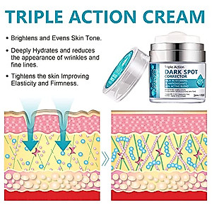Dark Spot Remover For Face, Dark Spot Corrector and Remover, Sun Spots Melasma Freckle Remover, Packed with vitamins and natural extracts to treat dark spots, age spots, or sunspots (A)