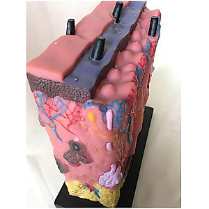 HAILIA Medical Models, Skin Anatomy Model,Hair Follicle Hair Anatomy Model Acne Pustule Blackhead Medical Teaching Model,for Medical Educational Training Aid,Study Display