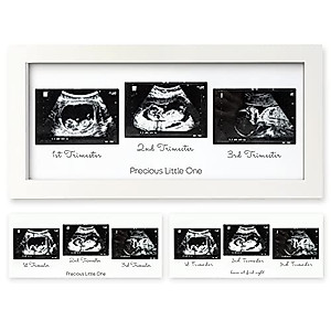 Sonogram Picture Frame - Trio Ultrasound Picture Frames For Mom To Be Gift - Baby Ultrasound frame - Pregnancy Announcements Sonogram frame - Baby Nursery Decor, Pregnant Mom Gifts (Alpine White)