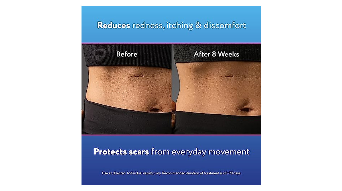 ScarAway Silicone Gel - Improve Scars Fast