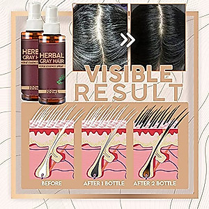 JDKD Herbal Gray Hair Reverse Essence Spray, Gray Off Hair Spray Restore Black Hair, Biotin Thickening Herbal Serum, Promote Hair Growth and Prevent Hair Loss (1PC)