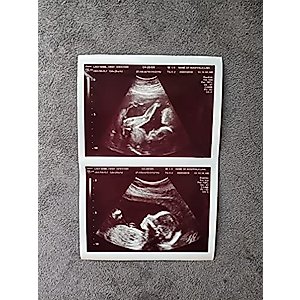 Prank 2D Customized Fake Ultrasound TWO PHOTOS Connected B&W
