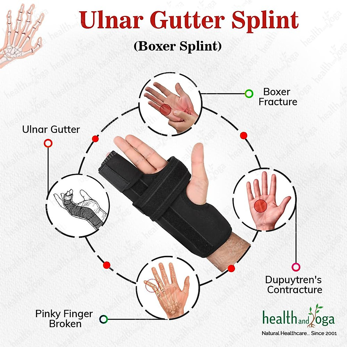 HealthAndYoga™ GuardNHeal Ulnar Gutter Boxer Splint – Must Use for Pinky Finger Splint, Boxer’s Fracture, Ulnar Gutter Wrist Brace, Metacarpal finger splint, Dupuytren's contracture - for Left or Right Hand (Large)
