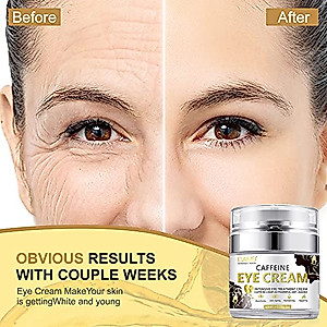 ELBBUB Caffeine Eye Cream, Anti Wrinkle Eye Cream and Puffiness-with Collagen, Puffiness, Wrinkles,Crows Feet Eye Lift Treatment For Men & Women